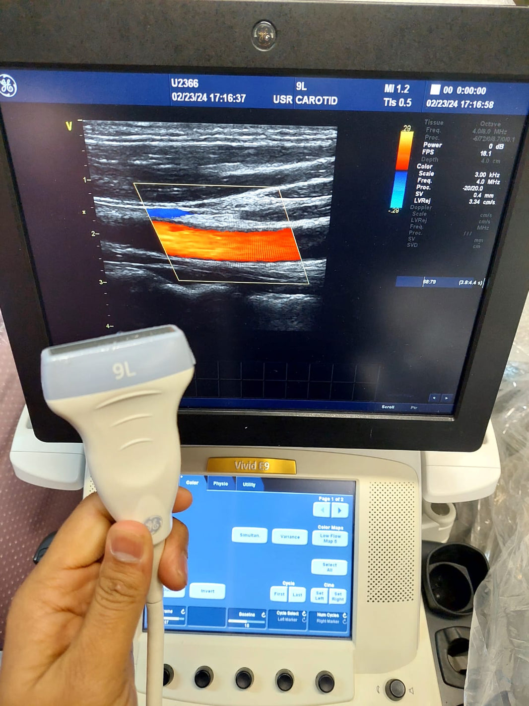ULTRASOUNDS usg sonography sonology echocardiography ultrasounds gynae ...